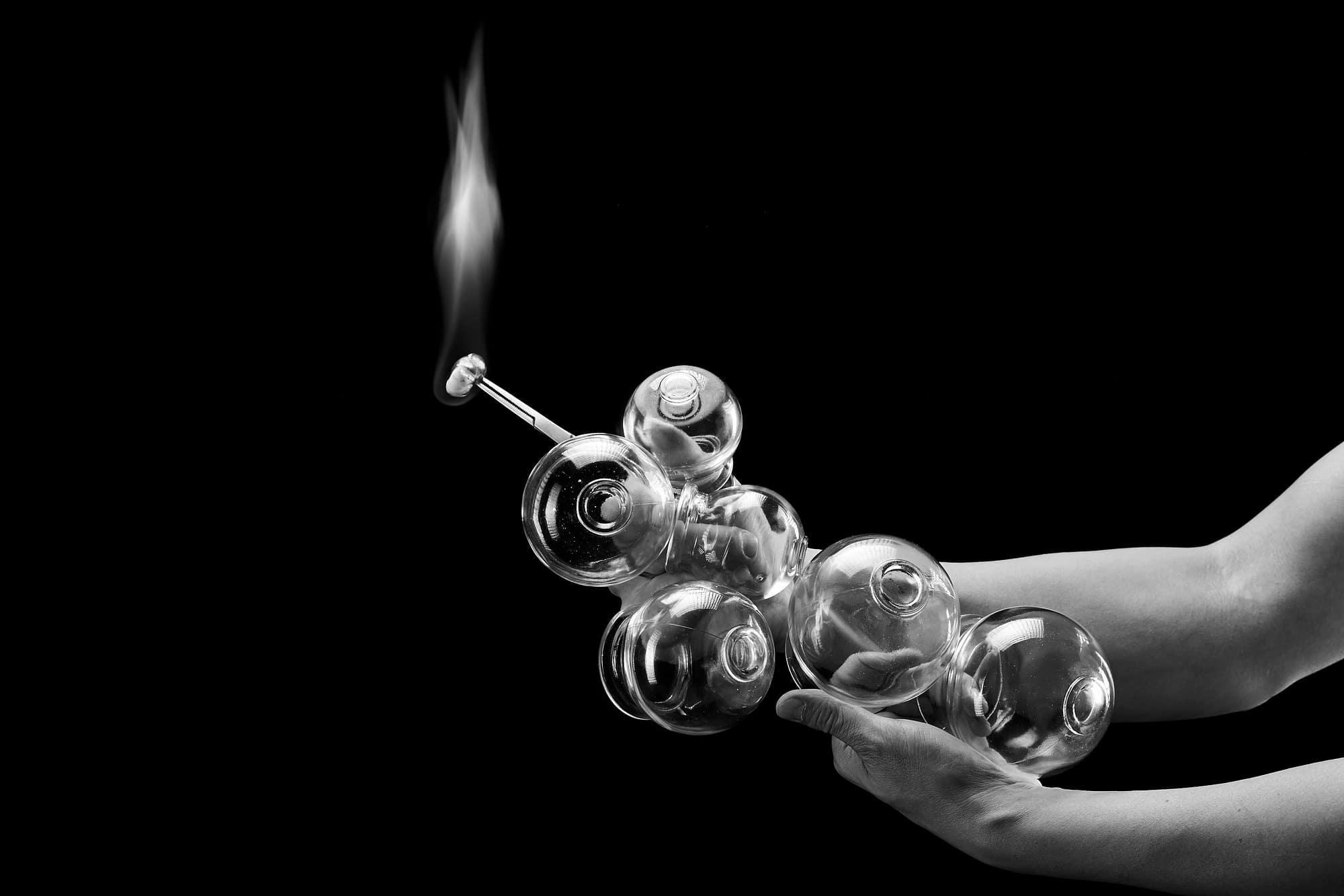 Traditional Chinese Medicine | Meridian Care